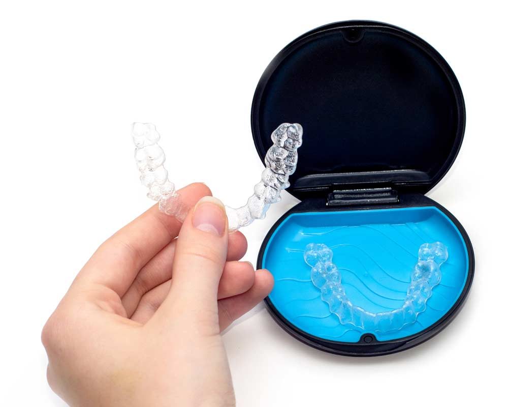 Invisalign in Toronto - Smile Dental - (647) 812 04 19